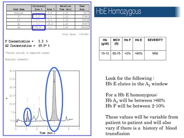 High Performance Liquid chromatography INTERPRETATION.ppt