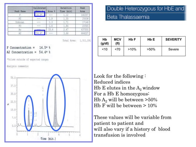 High Performance Liquid chromatography INTERPRETATION.ppt