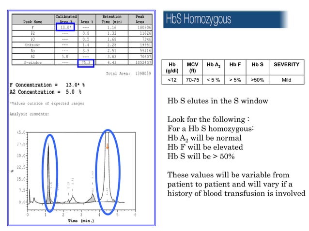 High Performance Liquid chromatography INTERPRETATION.ppt