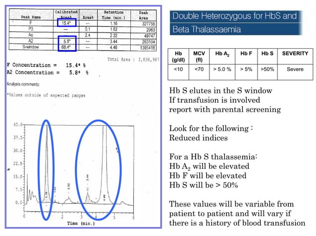 High Performance Liquid chromatography INTERPRETATION.ppt