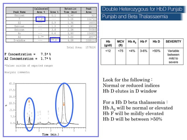 High Performance Liquid chromatography INTERPRETATION.ppt