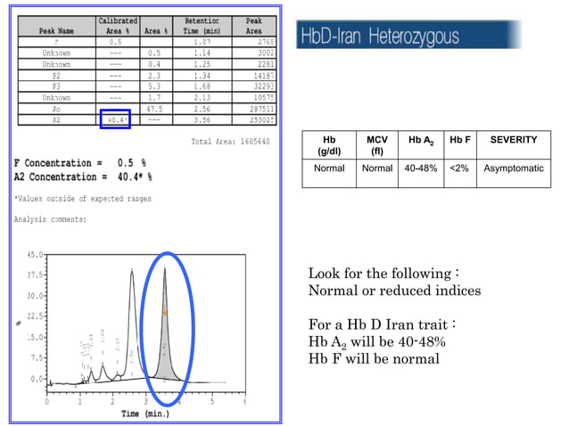 High Performance Liquid chromatography INTERPRETATION.ppt