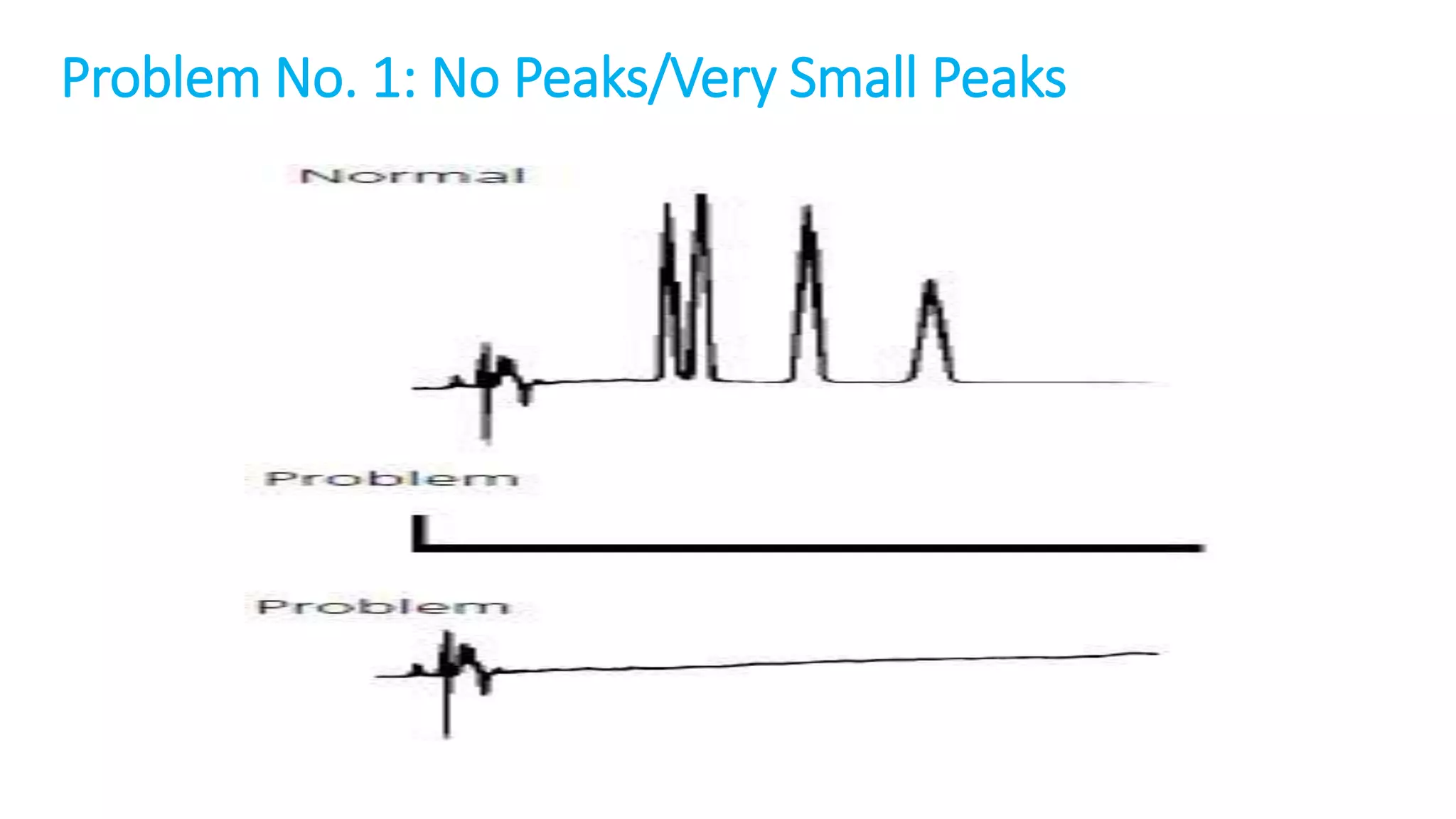 HPLC Problems, Probable Causes, and Remedies2020.pptx
