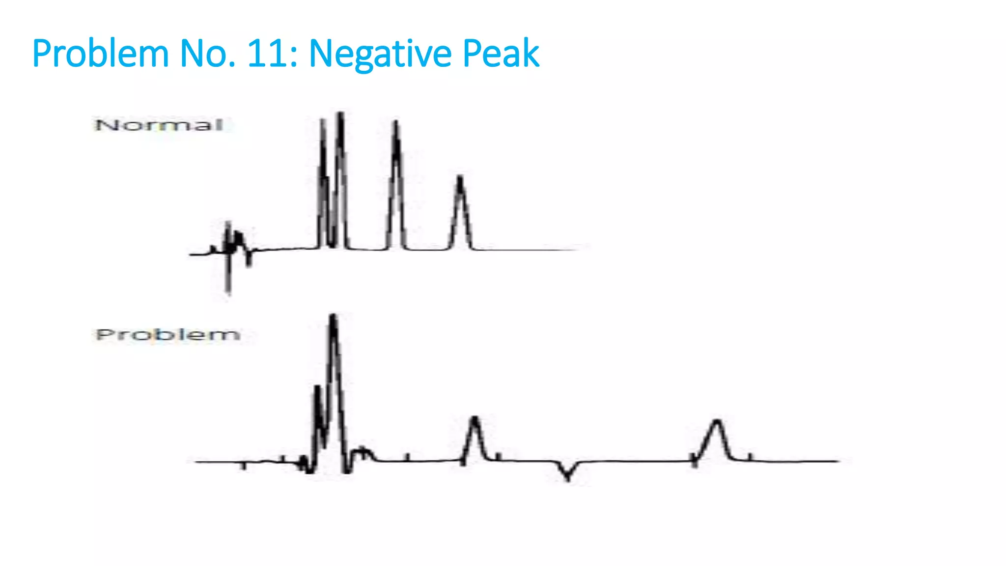 HPLC Problems, Probable Causes, and Remedies2020.pptx