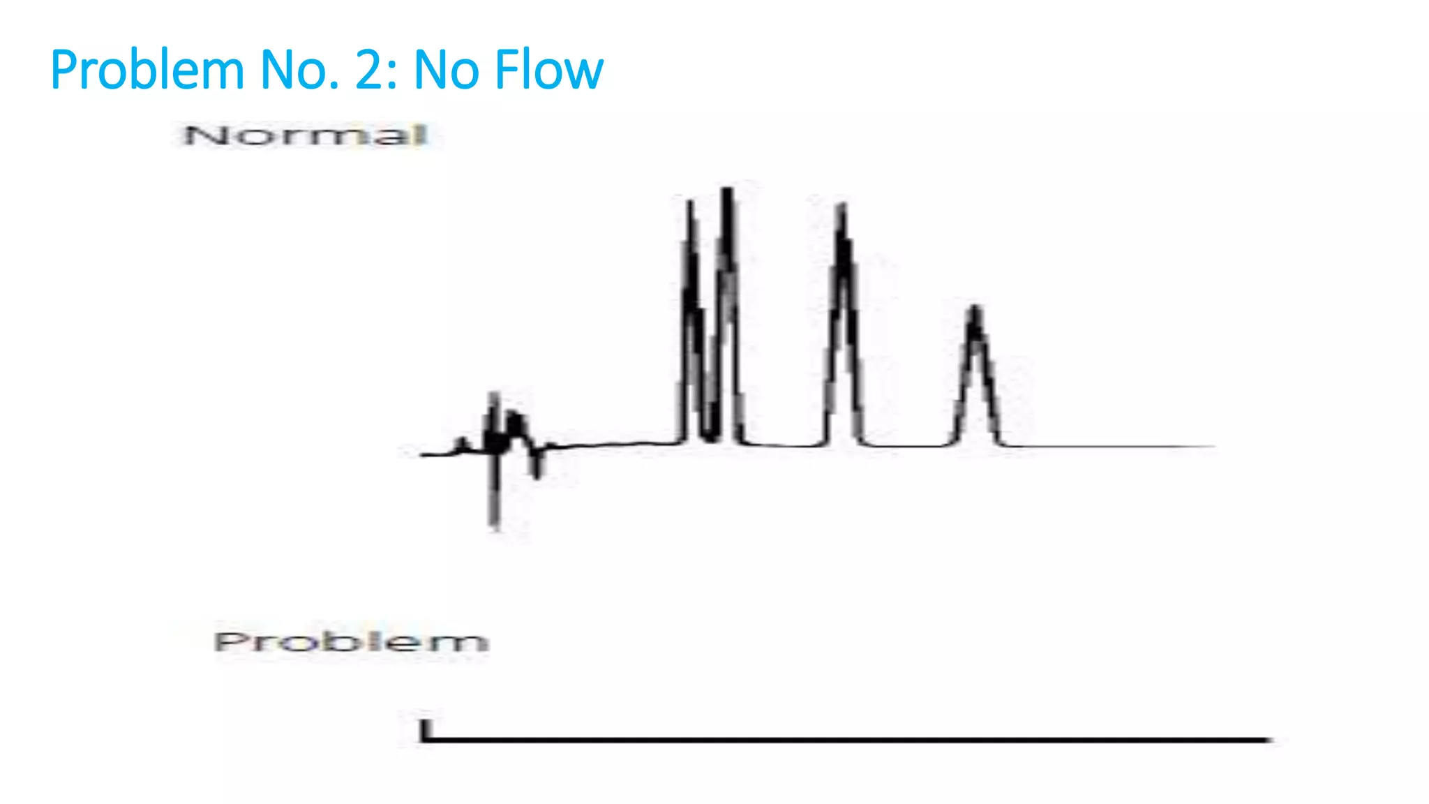 HPLC Problems, Probable Causes, and Remedies2020.pptx