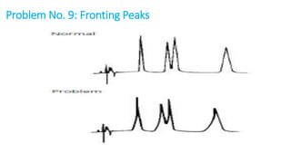 HPLC Problems, Probable Causes, and Remedies2020.pptx