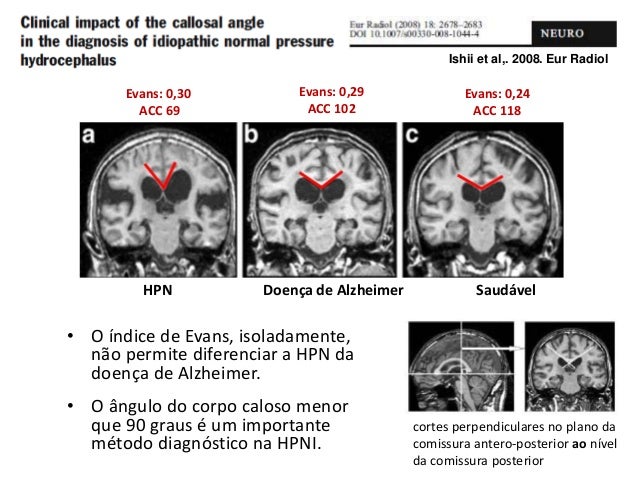 Hpn dx demencias.completo.st