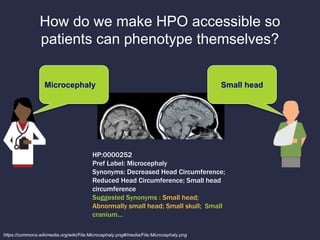 Enhancing the Human Phenotype Ontology for Use by the Layperson | PPTX ...