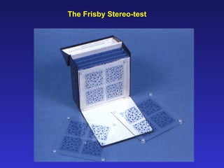 Assesment of streopsis | PPT