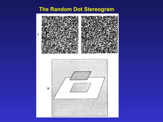 Assesment of streopsis | PPT