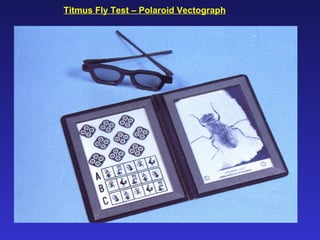 Assesment of streopsis | PPT