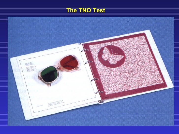 Assesment of streopsis