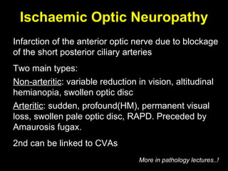 ocular diff diaganosis 1 | PPT