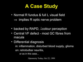 ocular diff diaganosis 1 | PPT