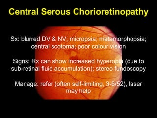 ocular diff diaganosis 1 | PPT