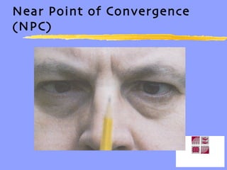 convergence | PPT