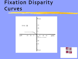 fixation disparity | PPT