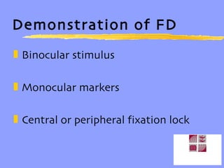 fixation disparity | PPT