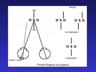 Horizontal Deviations | PPT