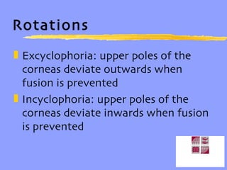 ocular Deviations | PPT