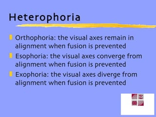 ocular Deviations | PPT