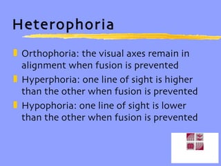 ocular Deviations | PPT