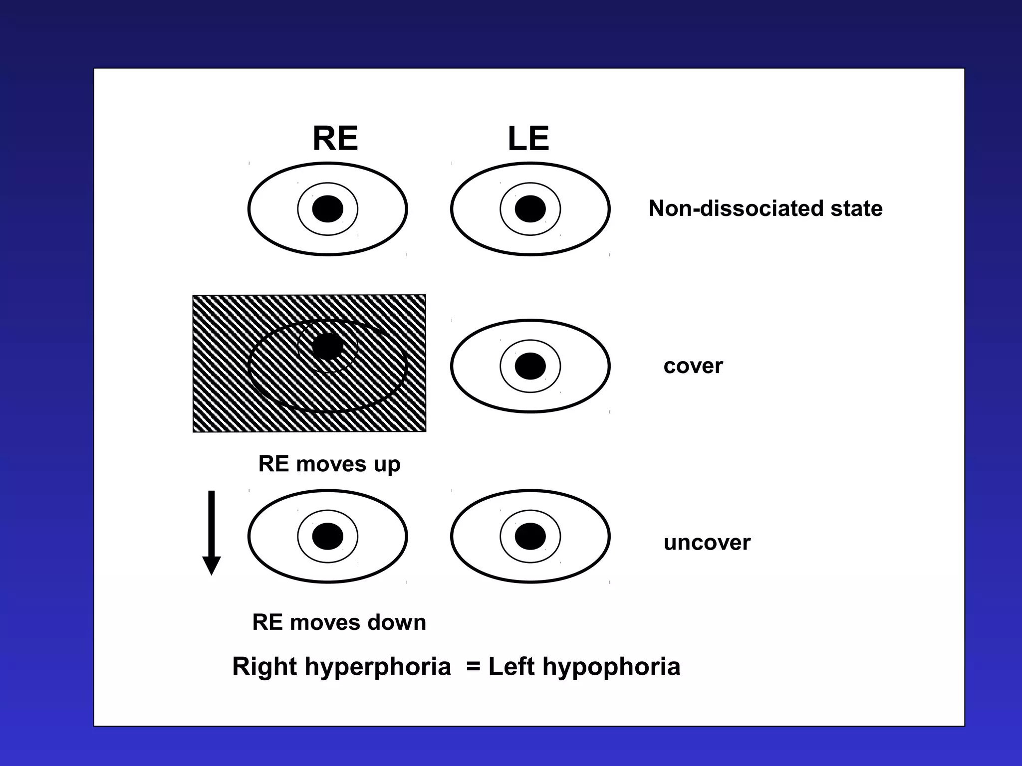 Hpptfilesbradfordresourcesbinocularfilesverticaldeviations 090317000106 ...