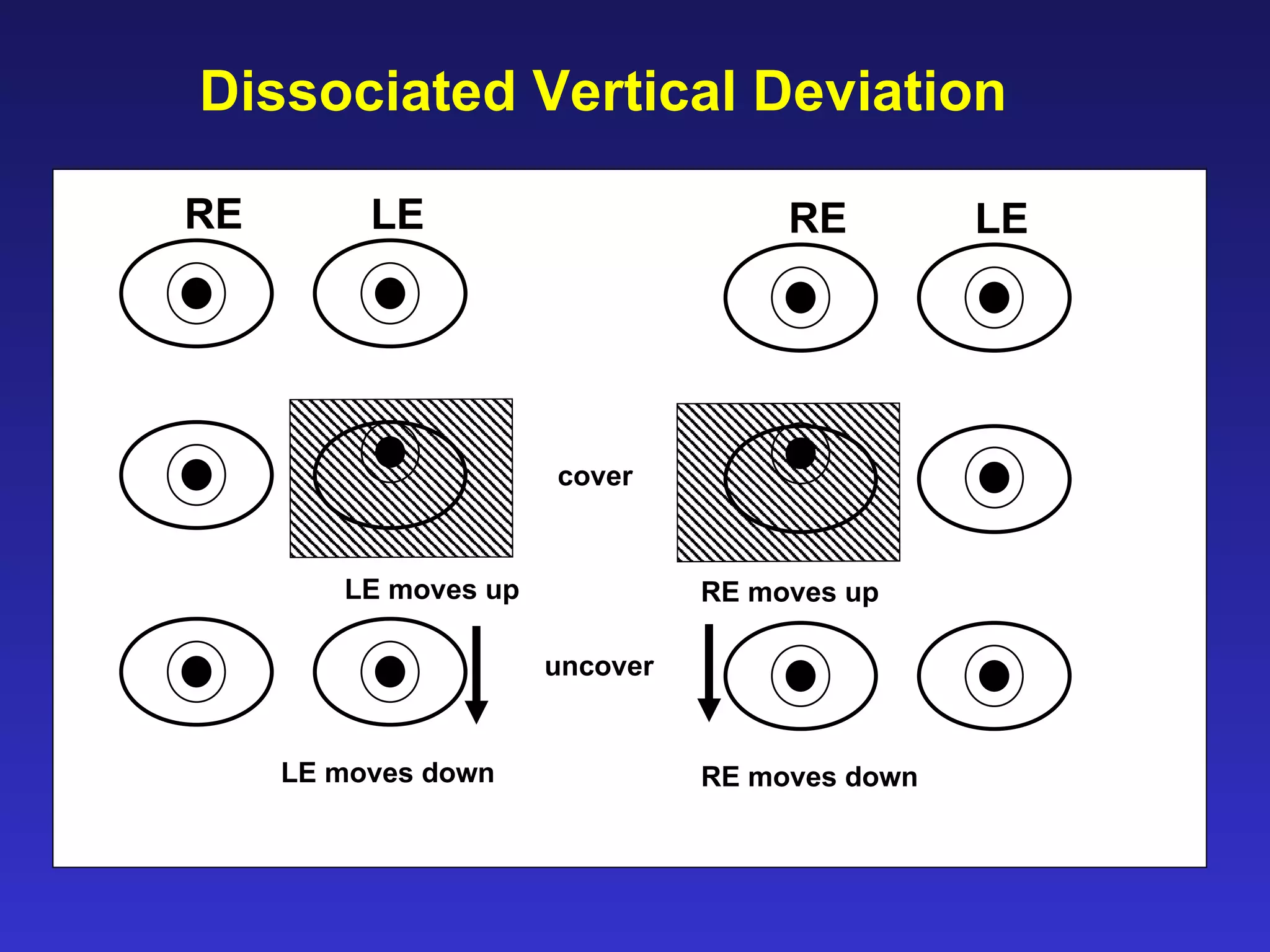Vertical Deviations | PPT