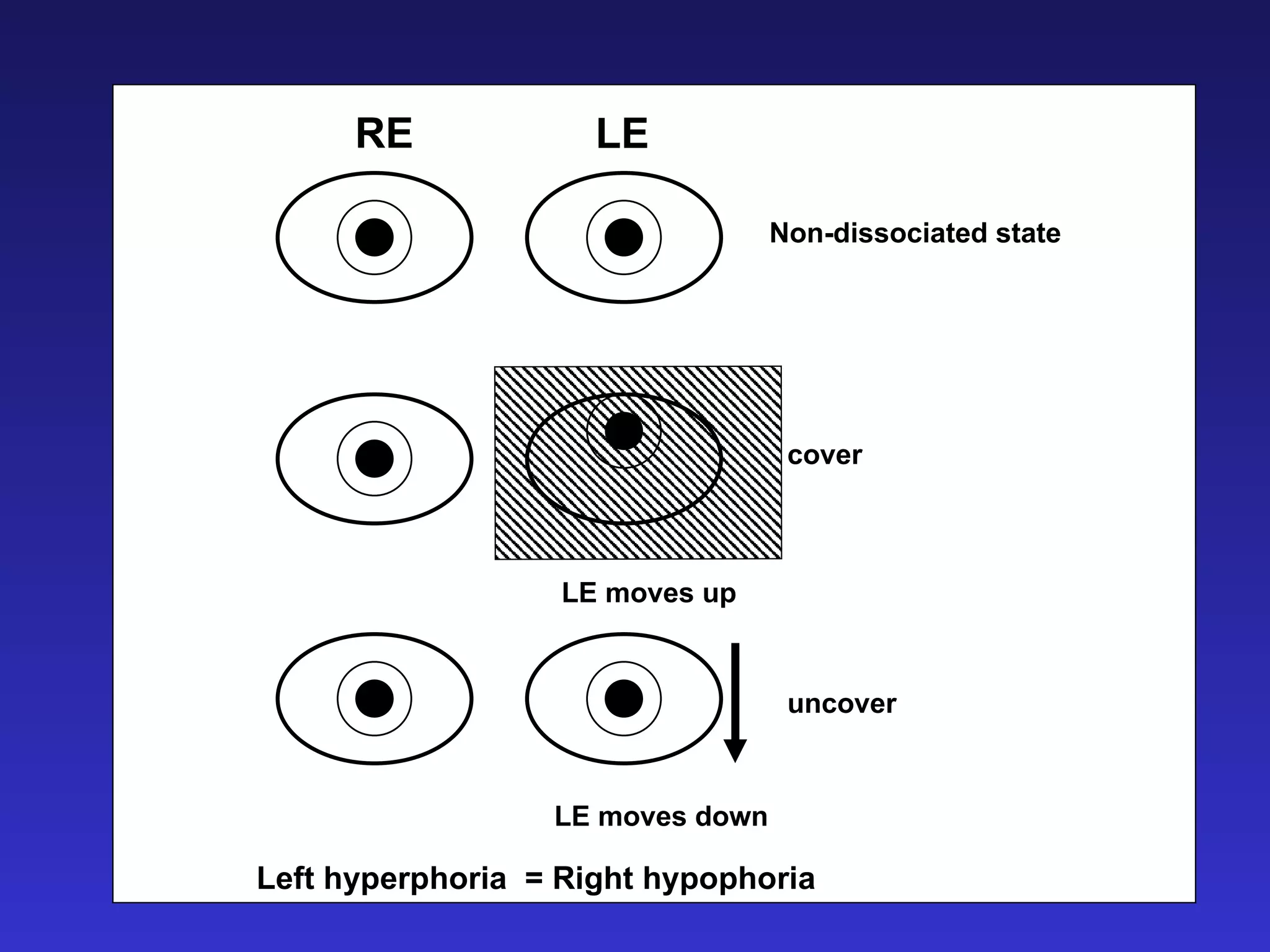 Vertical Deviations | PPT