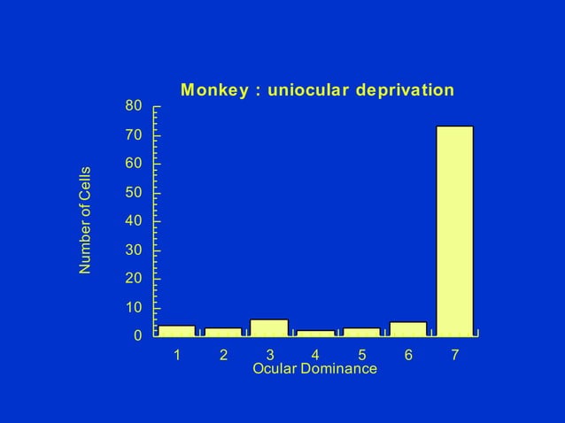 Studies of abnormal visual development | PPT | Eye and Vision ...