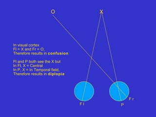 Sensory Adaptation to Strabismus | PPT