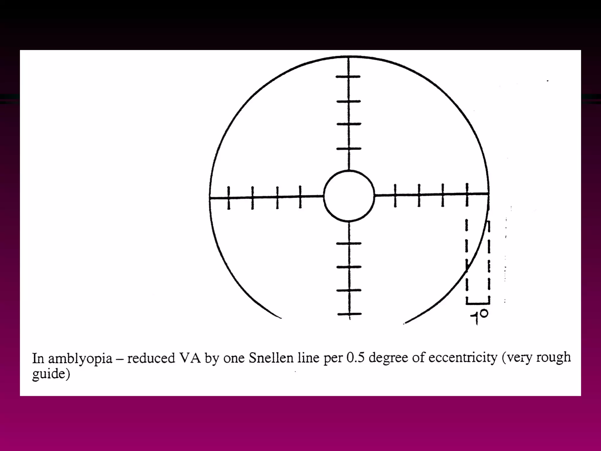 Eccentric Fixation | PPT