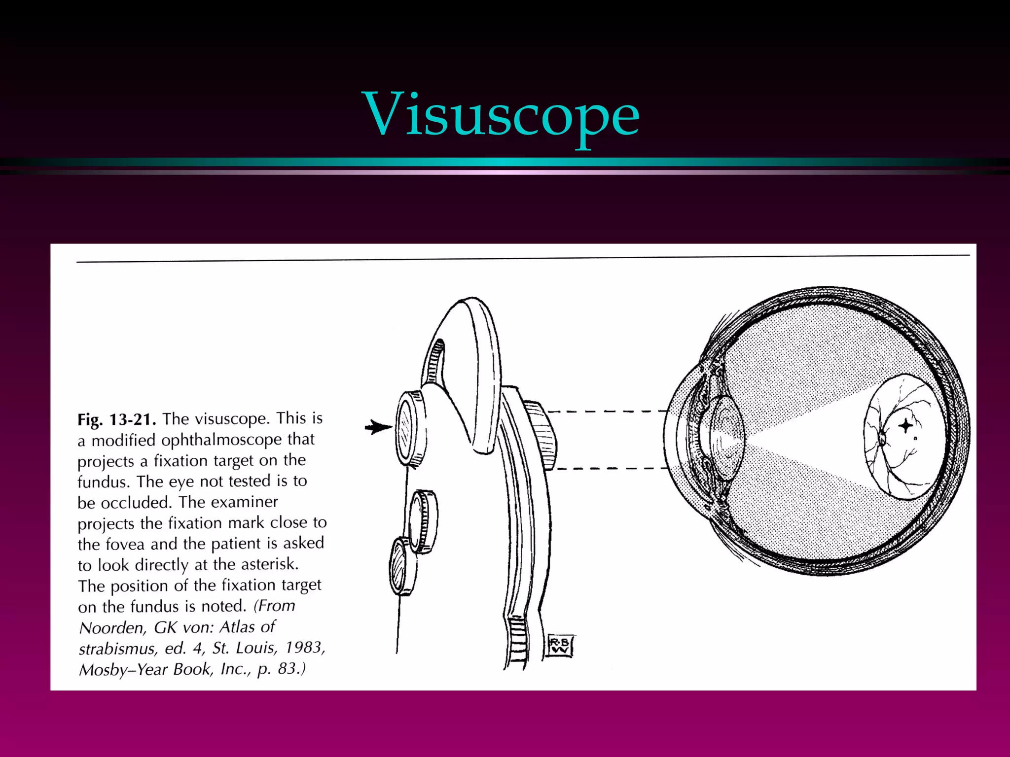 Eccentric Fixation | PPT