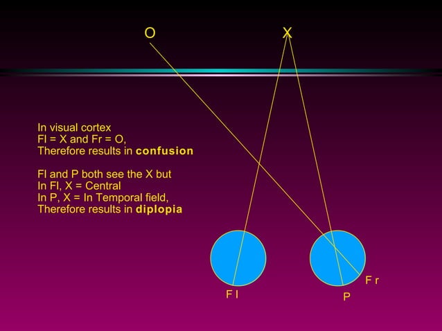 Eccentric Fixation | PPT
