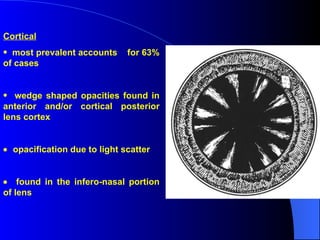 Assessment & management of patients with cataract | PPT