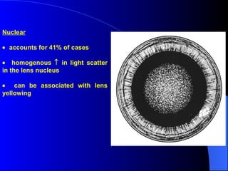 Assessment & management of patients with cataract | PPT
