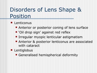DISORDERS OF THE CRYSTALLINE LENS | PPT