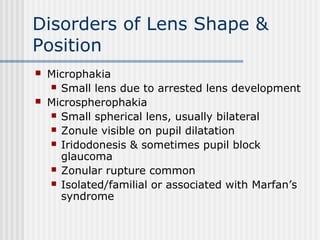 DISORDERS OF THE CRYSTALLINE LENS | PPT