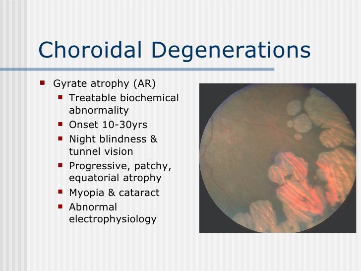 VASCULAR AND HEREDITARY RETINAL DISEASE