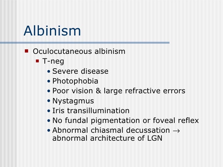 Oculocutaneous Albinism Retina