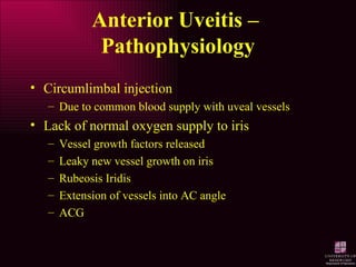 Anterior Uveitis | PPT