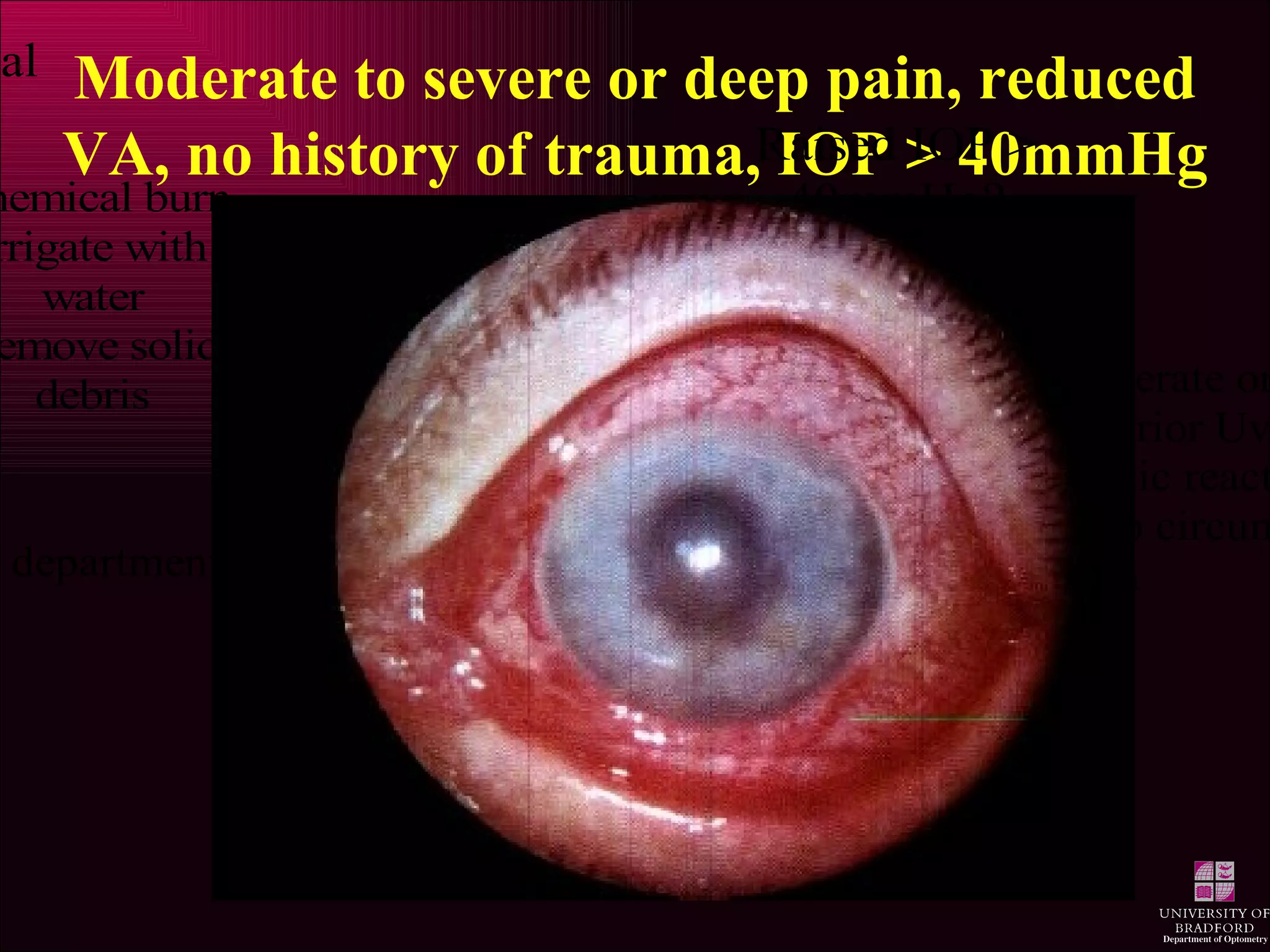 Differential Diagnosis of Red Eye | PPT