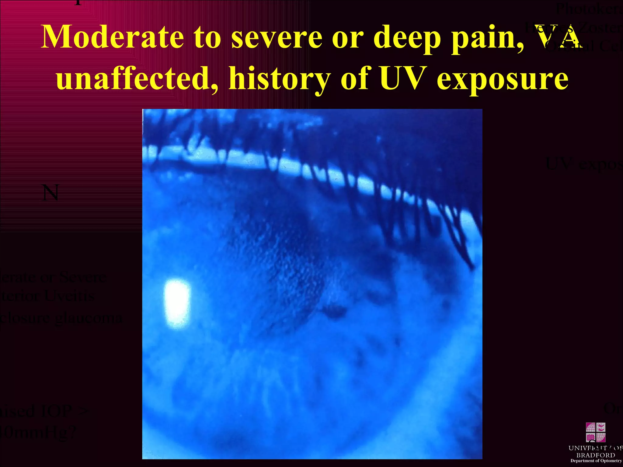 Differential Diagnosis of Red Eye | PPT