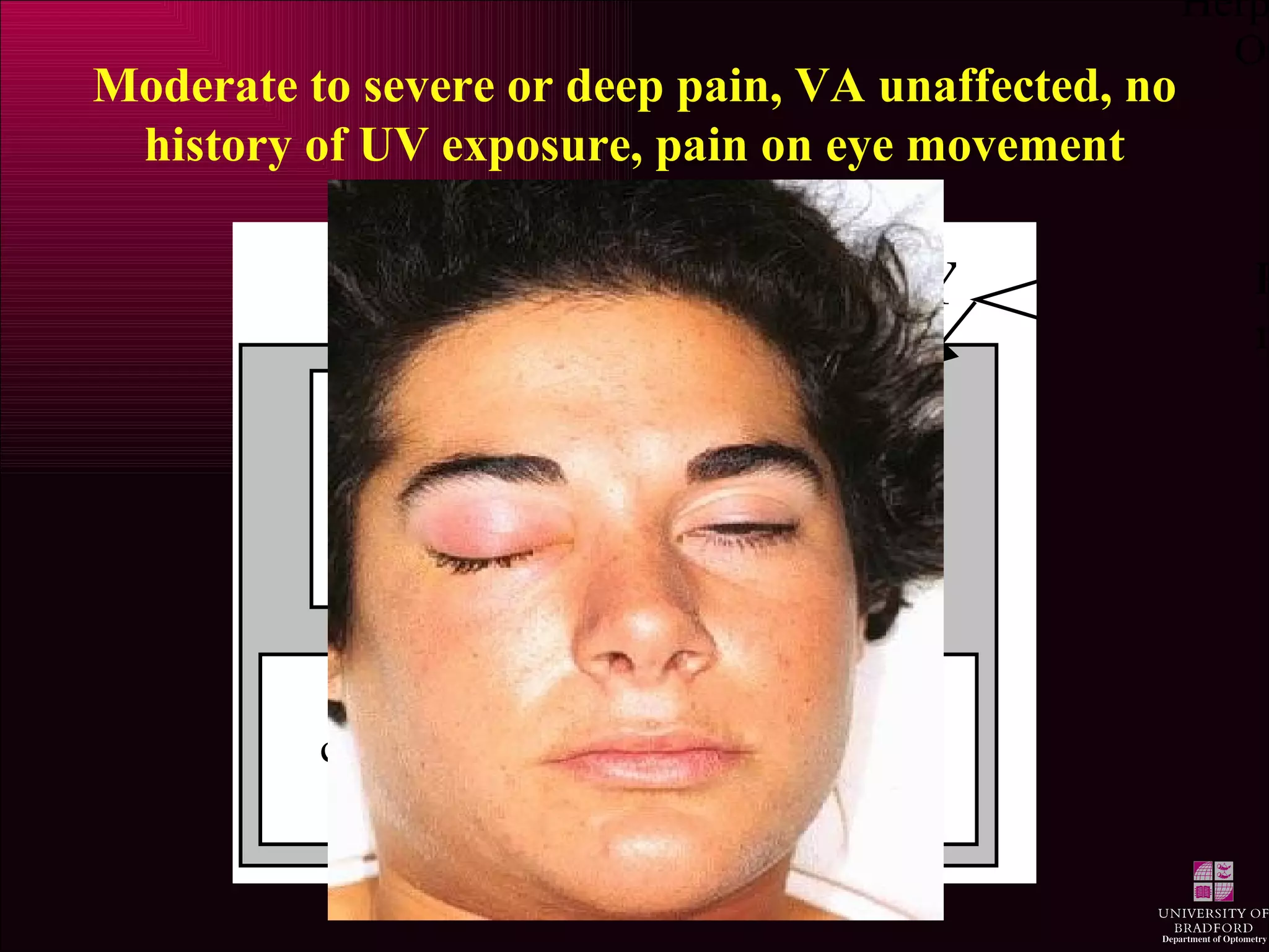 Differential Diagnosis of Red Eye | PPT