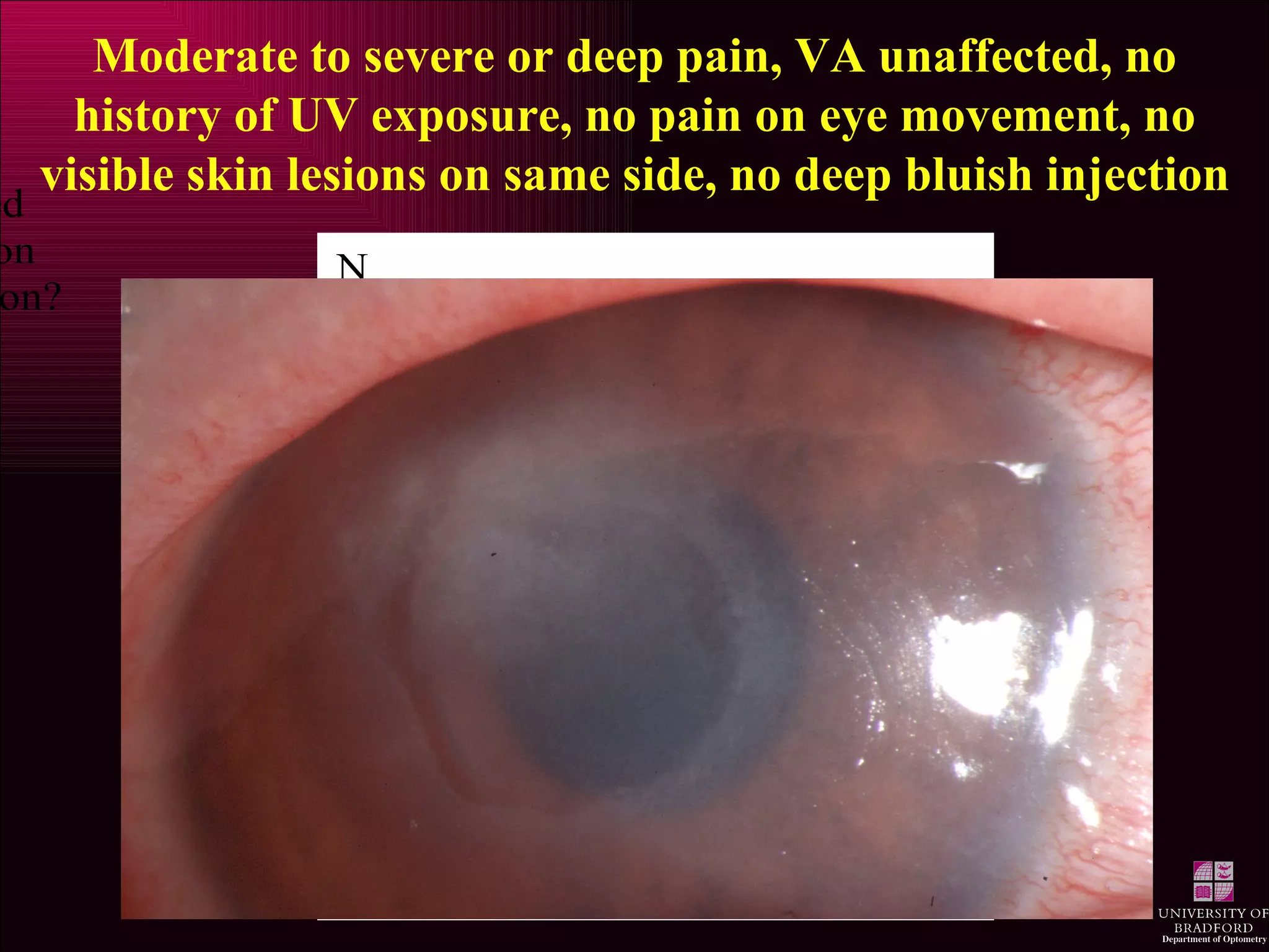 Differential Diagnosis of Red Eye | PPT