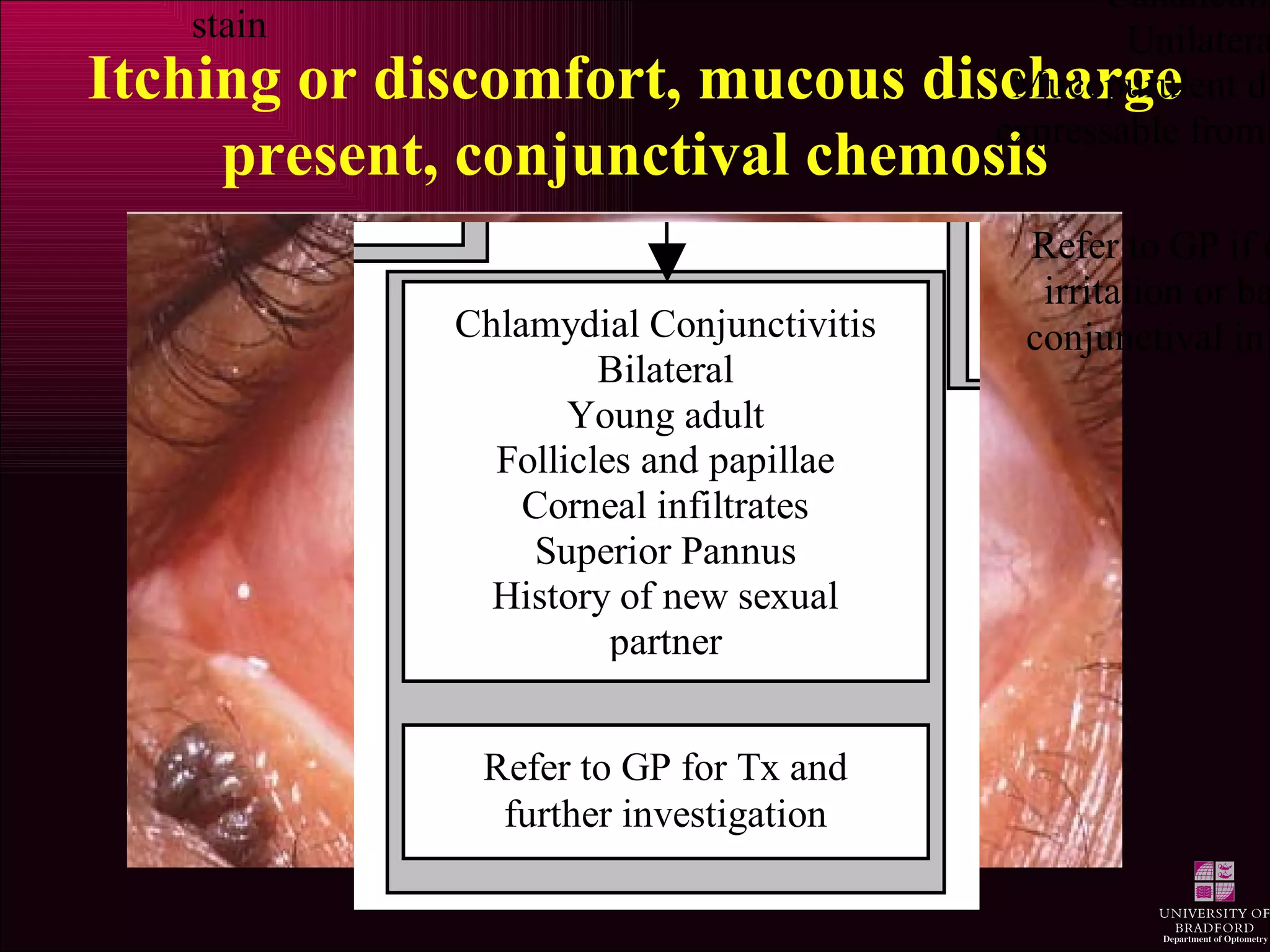 Differential Diagnosis of Red Eye | PPT
