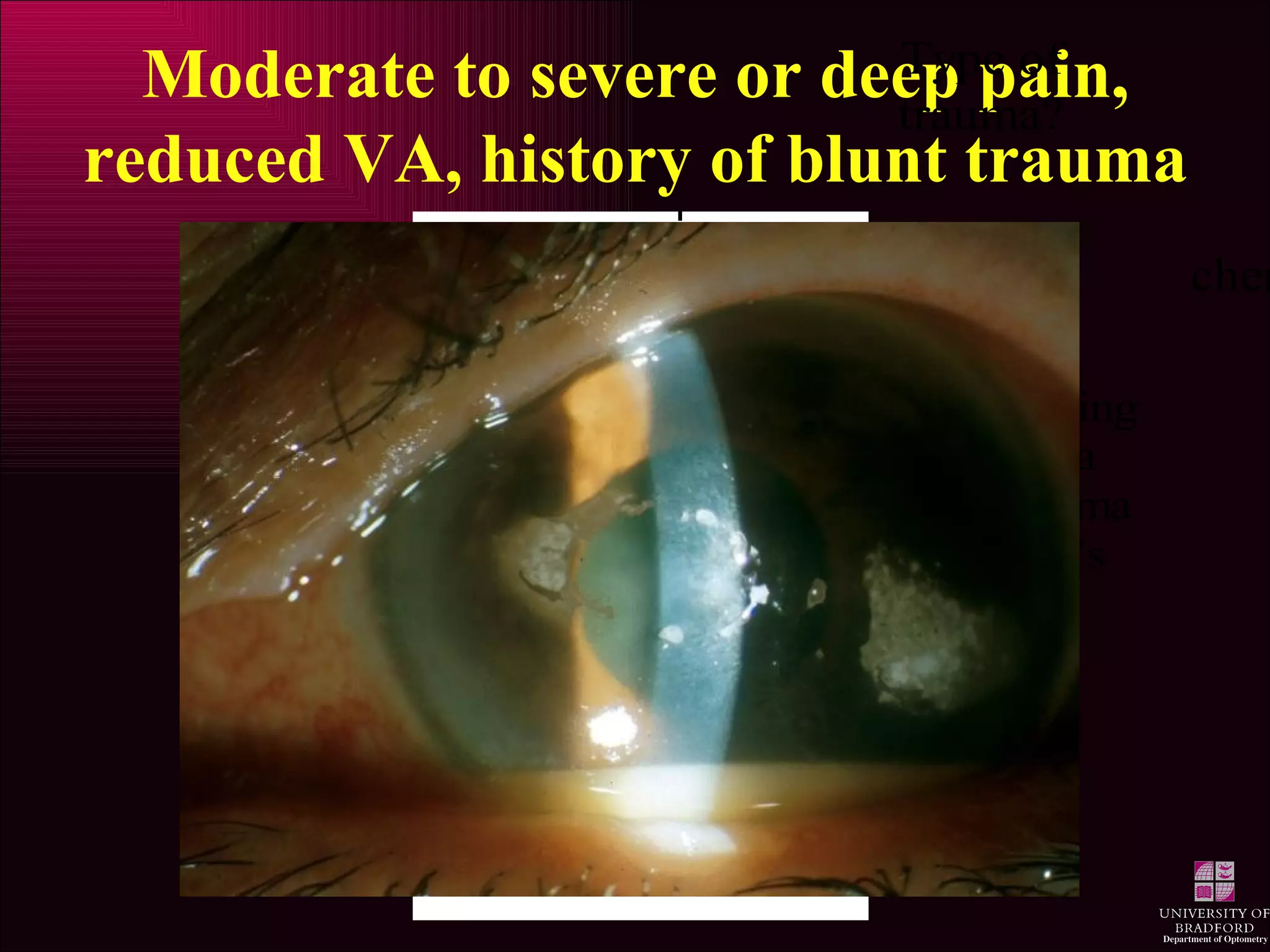 Differential Diagnosis of Red Eye | PPT