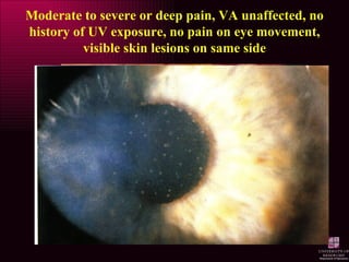 Differential Diagnosis of Red Eye | PPT