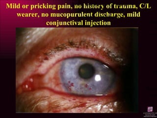 Differential Diagnosis of Red Eye | PPT