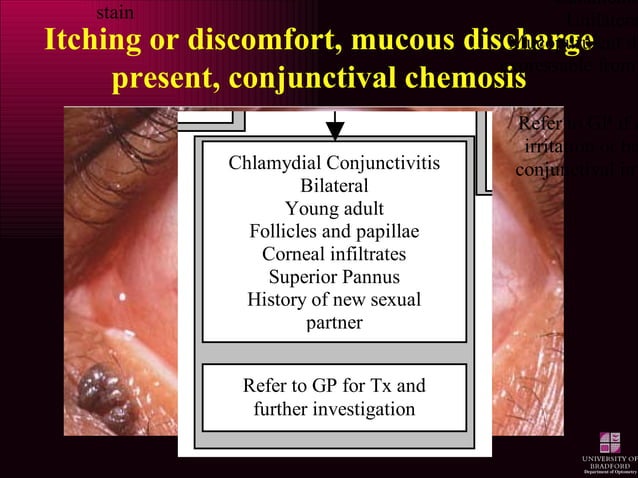 Differential Diagnosis of Red Eye | PPT